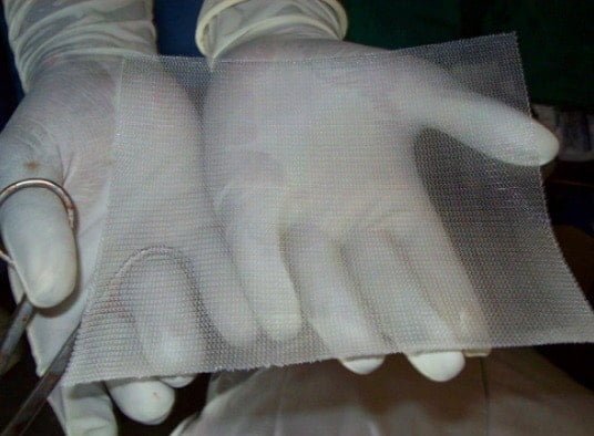 Hernia in animals | Various types of hernia and Explanation