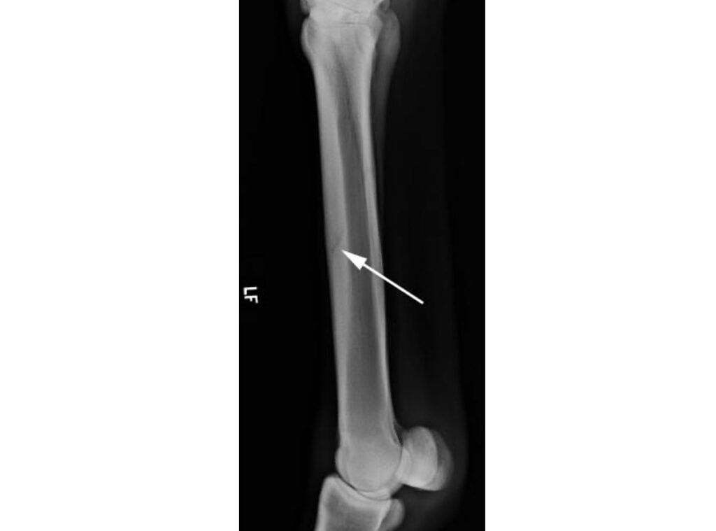Bucked Shins in horses - Dorsal Metacarpal Disease