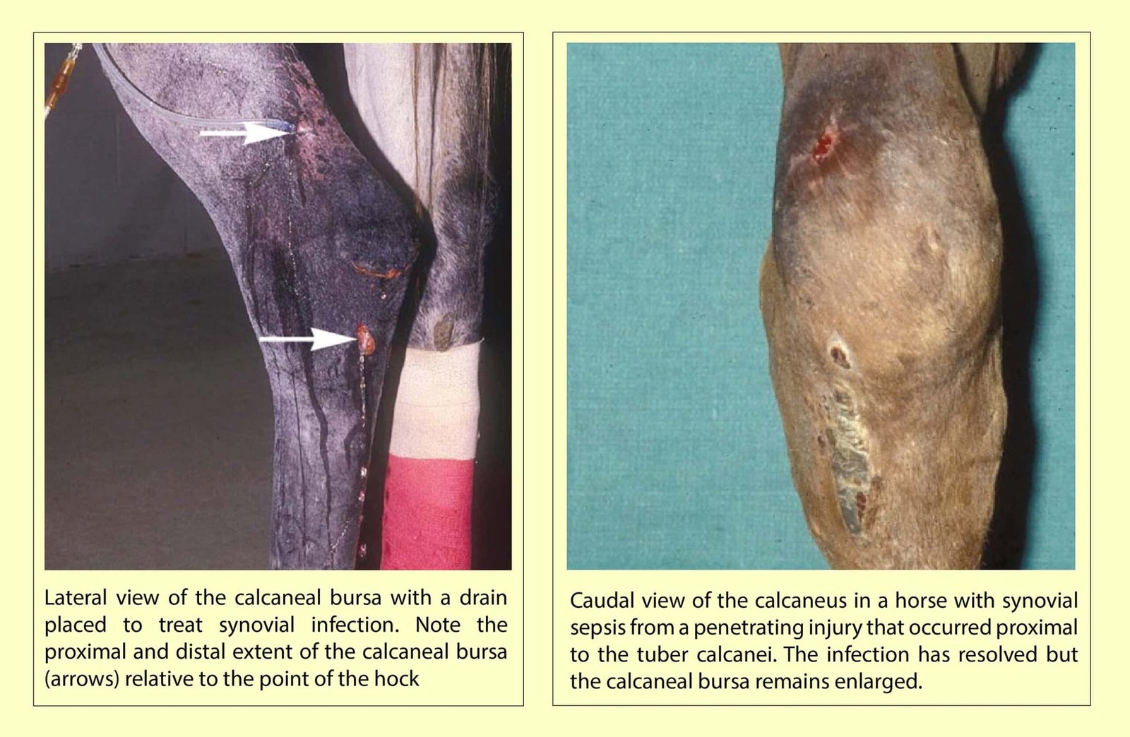 Capped Hock in Horses or Calcaneal Bursitis