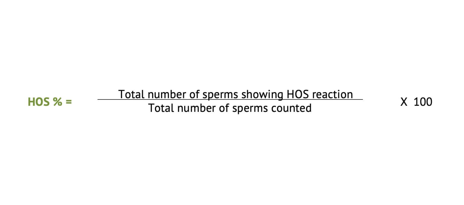 Hypo Osmotic Swelling Test (HOST) in Semen Evaluation