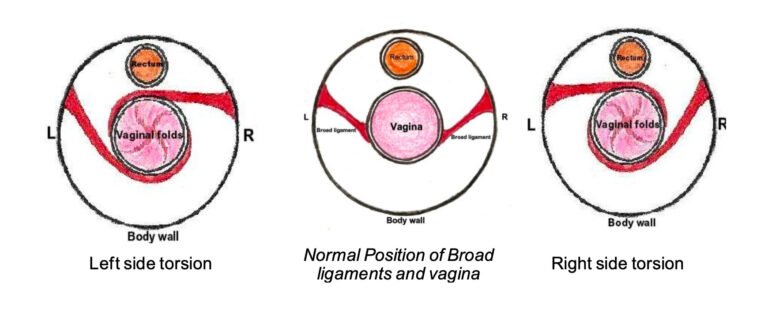 Torsion of the Uterus | Uterine Volvulus or Torsio Uteri in Animals