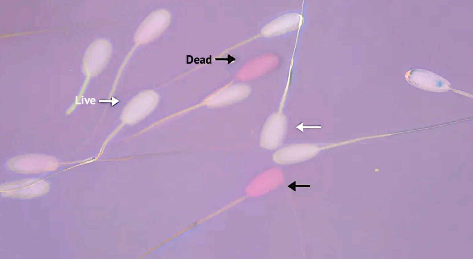 Live and Dead Sperm Estimation | Procedure and Interpretation