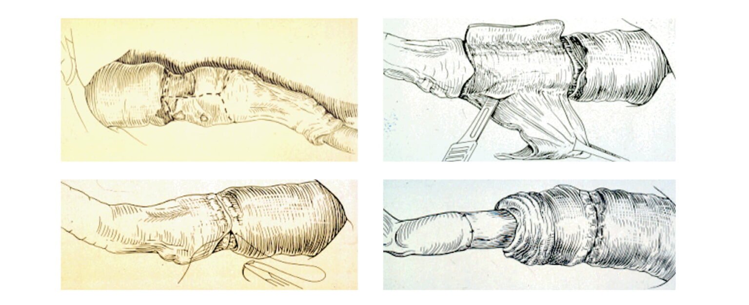 Reefing (Segmental Posthetomy) in Bulls | Surgical Technique